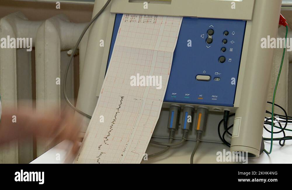 Fetal monitoring diagram of pregnant woman. (heartbeat Fetal Monitoring ...