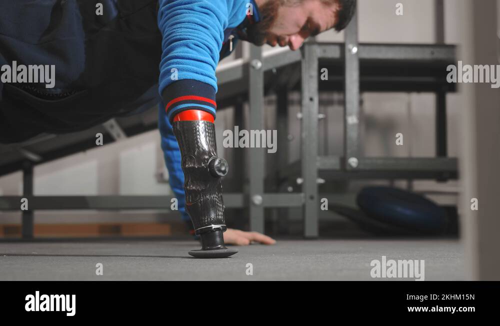 Prosthetic arm exercise Stock Videos & Footage - HD and 4K Video Clips ...