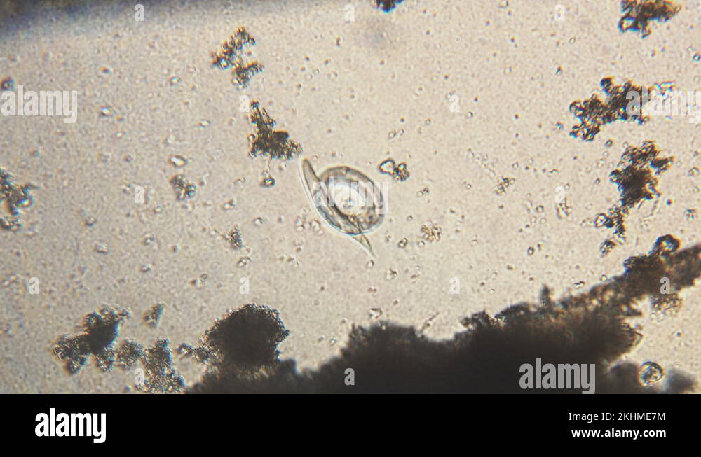 Microscopy of parasite worm nematode (Strongyloides stercoralis ...
