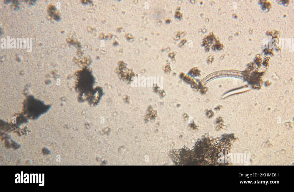 Microscopy of parasite worm nematode (Strongyloides stercoralis ...