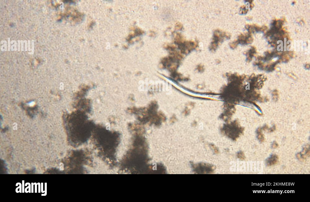 Microscopy of parasite worm nematode (Strongyloides stercoralis). Movement of ac Stock Video ...