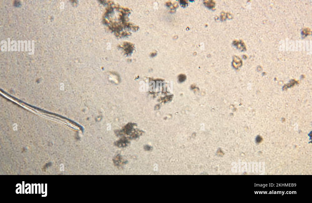 Microscopy Of Parasite Worm Nematode Strongyloides Stercoralis Movement Of Ac Stock Video