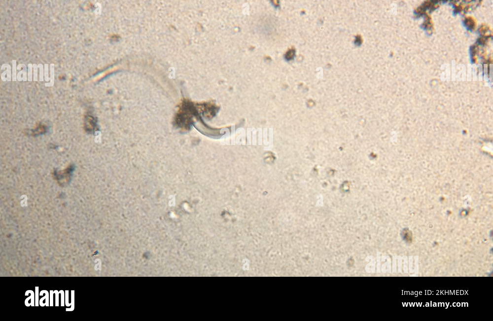 Microscopy of parasite worm nematode (Strongyloides stercoralis). Movement of ac Stock Video ...