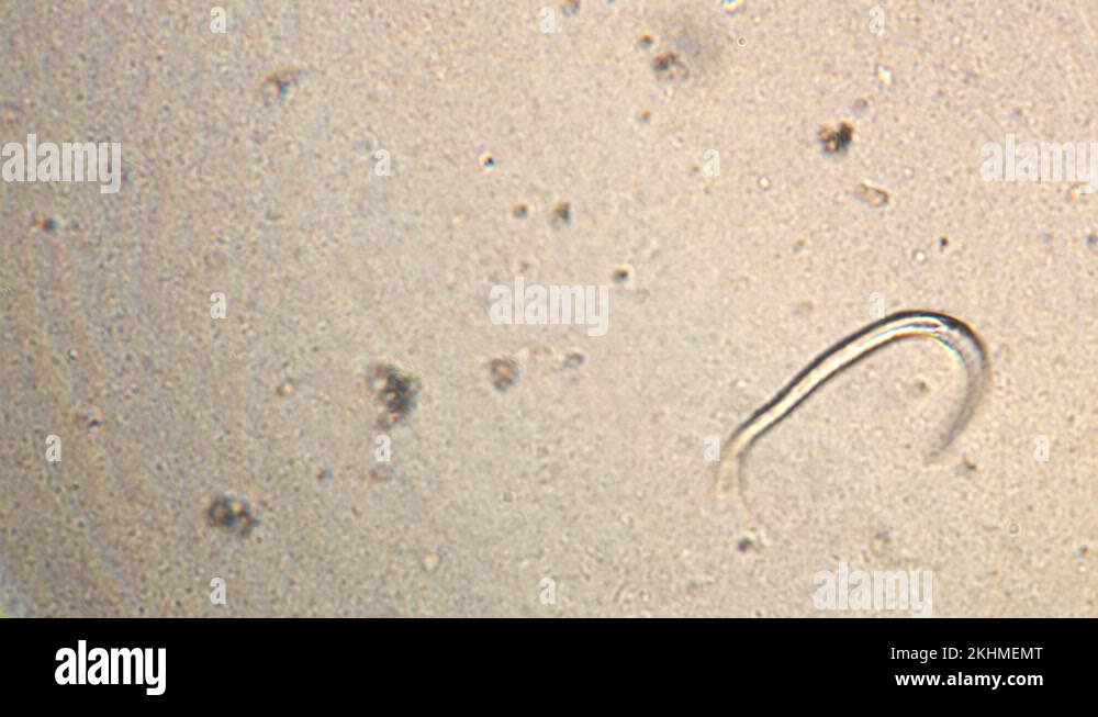 Microscopy of parasite worm nematode (Strongyloides stercoralis ...