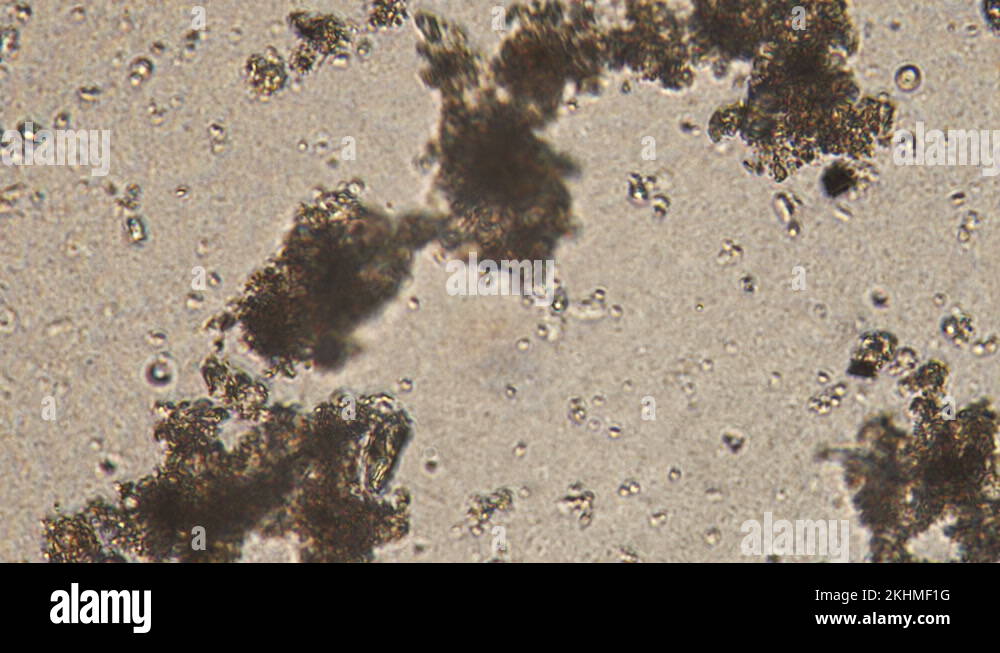 Microscopy of protozoa ciliate and small microorganisms in the water ...