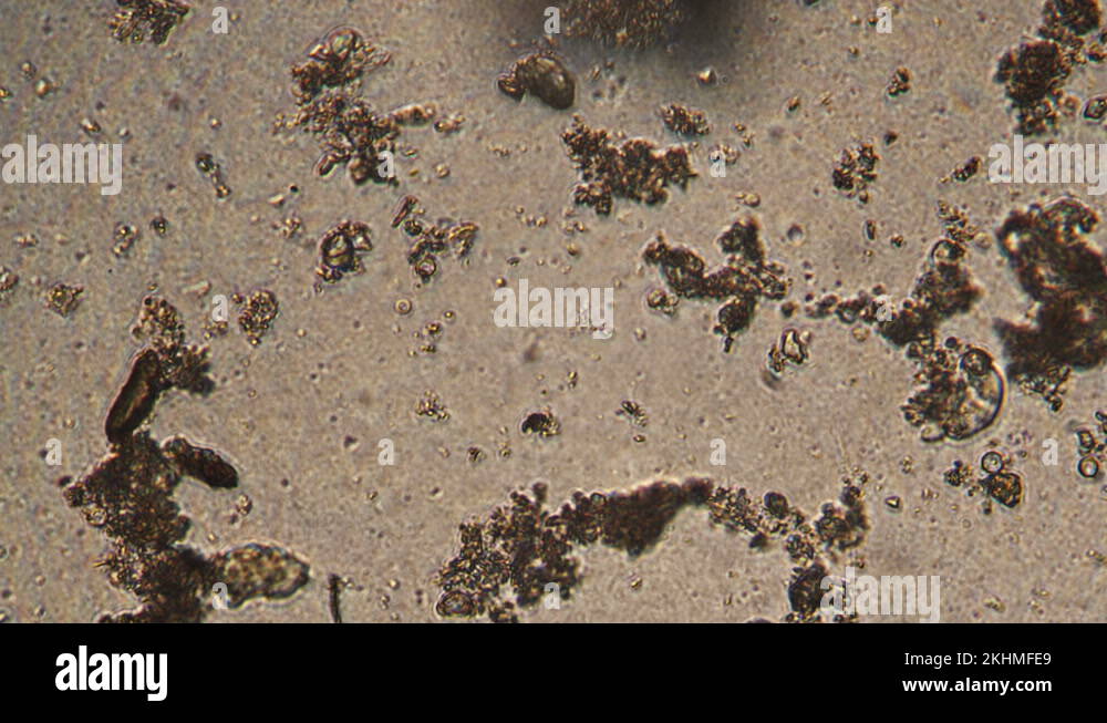 Microscopy of protozoa ciliate and small microorganisms in the water ...