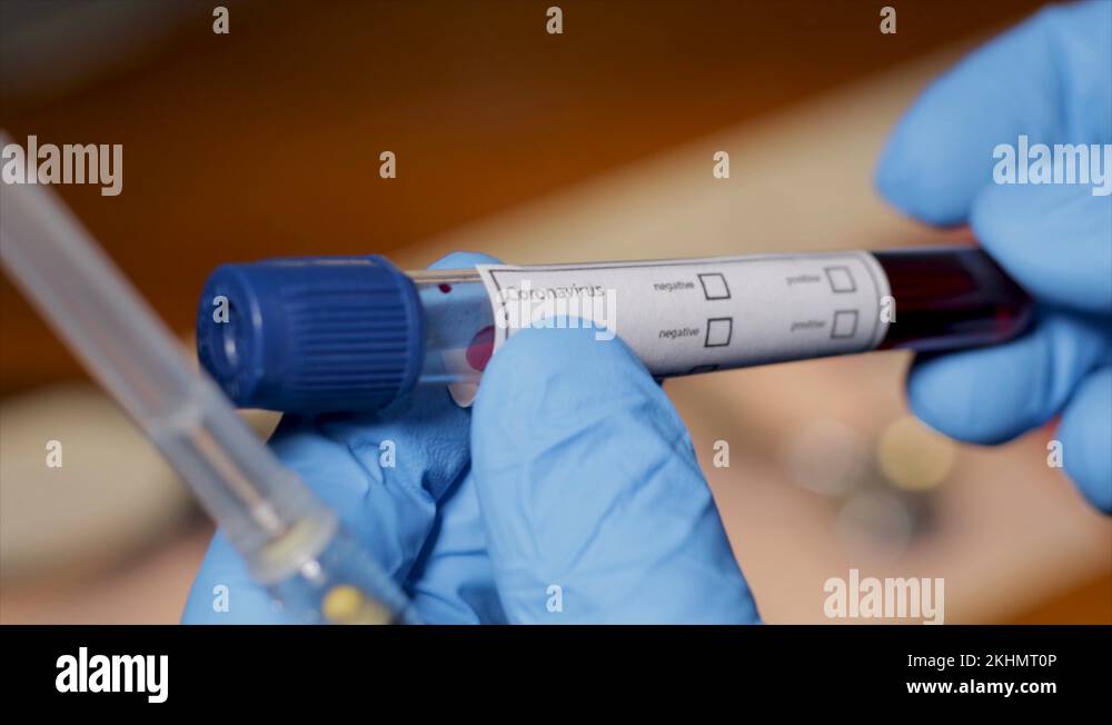 Respiratory syndrome coronavirus pandemic Stock Videos & Footage - HD ...