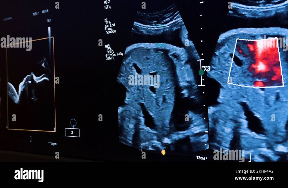 Imaging sonar Stock Videos & Footage - HD and 4K Video Clips - Alamy