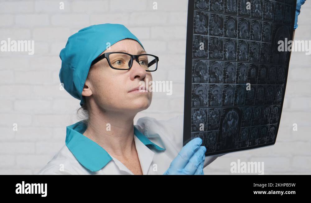 female doctor examining MRI images of human brain Stock Video Footage ...