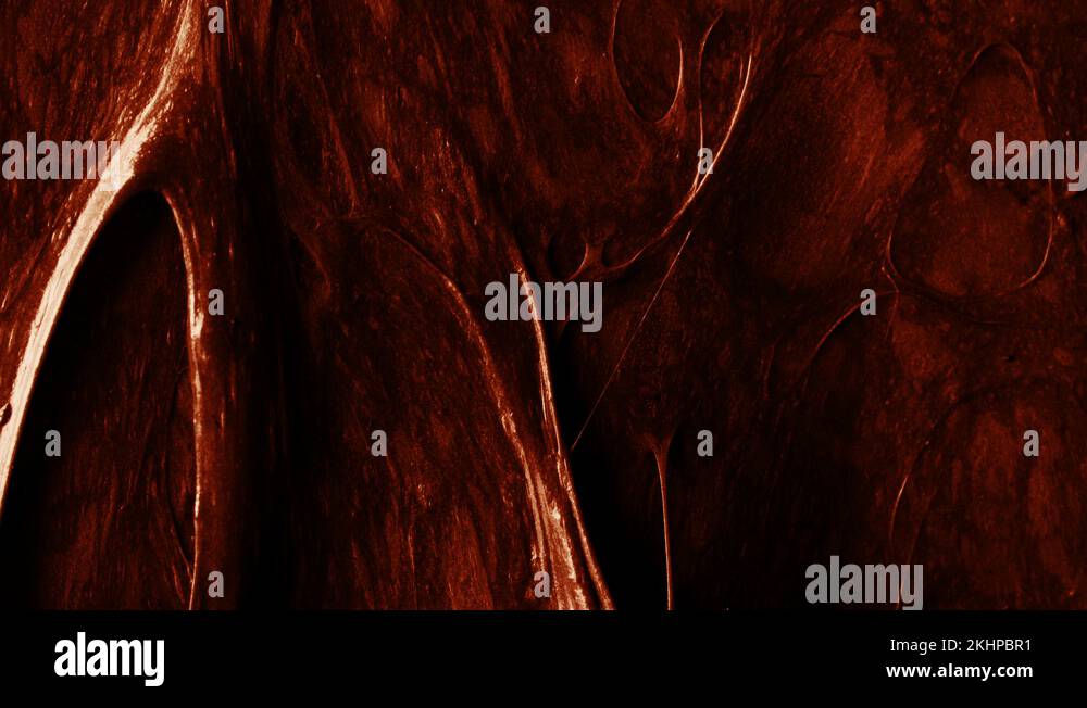 Stretching and rupture of ligaments and tendons during prolonged muscle ...