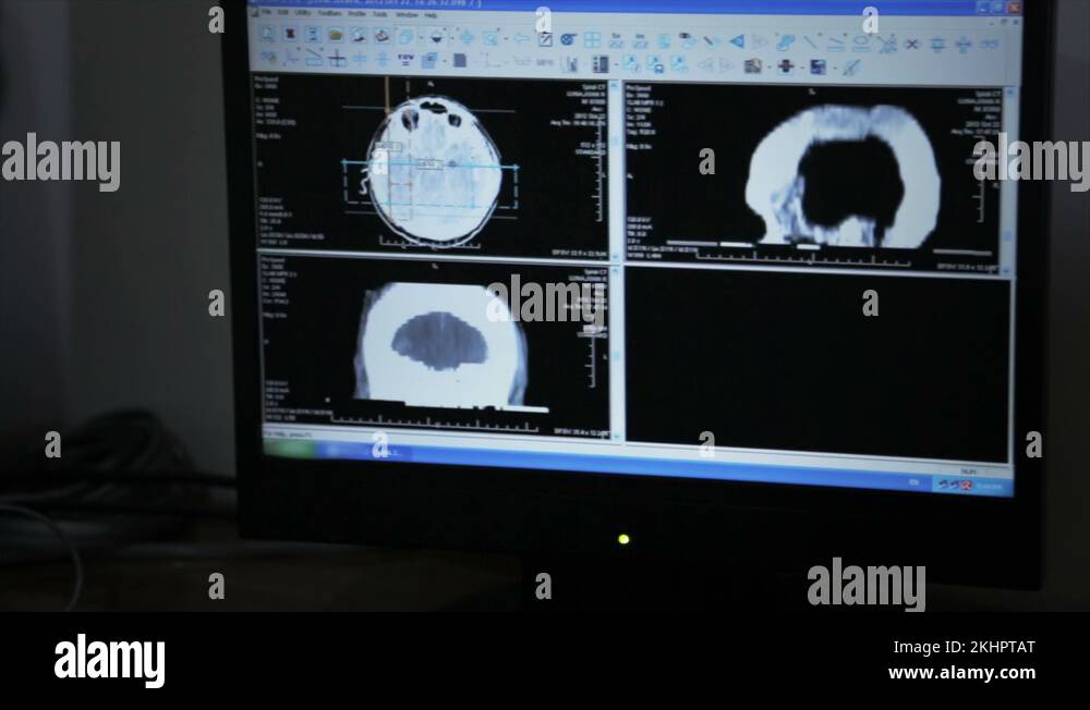 Neuroimaging Stock Videos & Footage - HD and 4K Video Clips - Alamy
