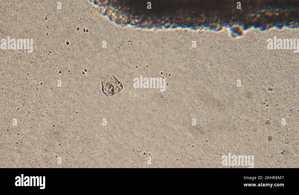 Microscopy of protozoa in the water sample. Magnification 150x ...