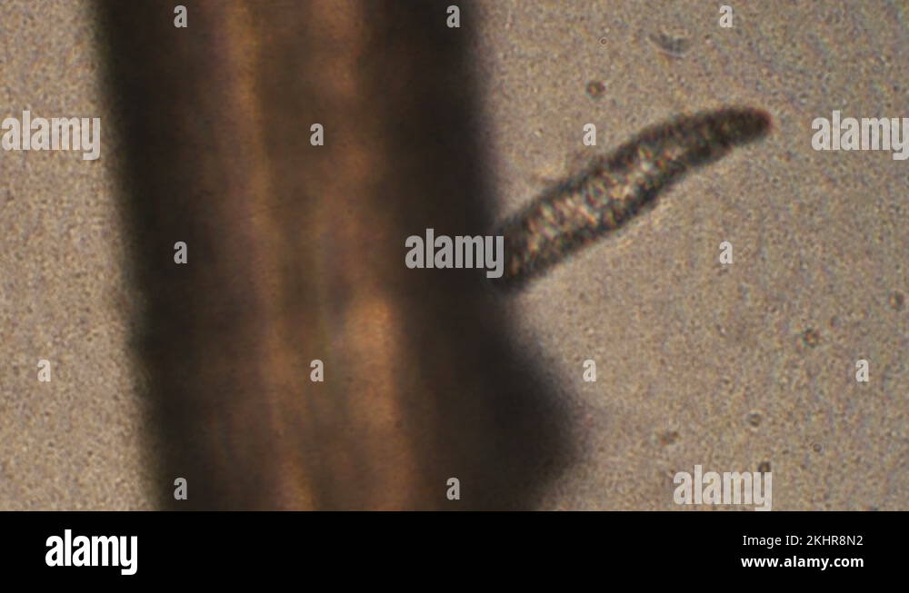 Demodex folliculorum Stock Videos & Footage - HD and 4K Video Clips - Alamy