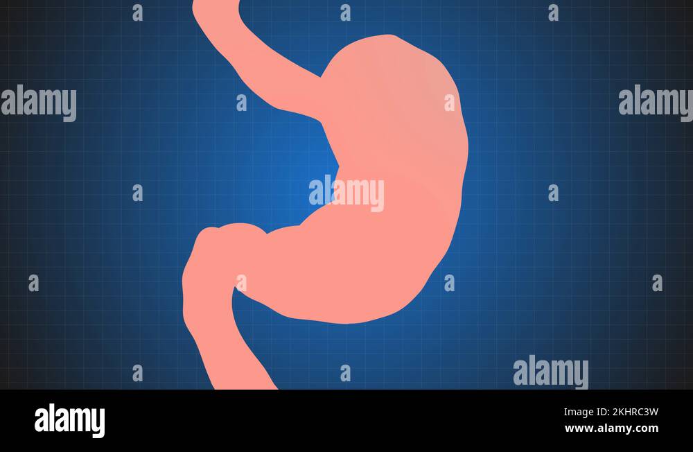 Abdominal pain cartoon Stock Videos & Footage - HD and 4K Video Clips ...