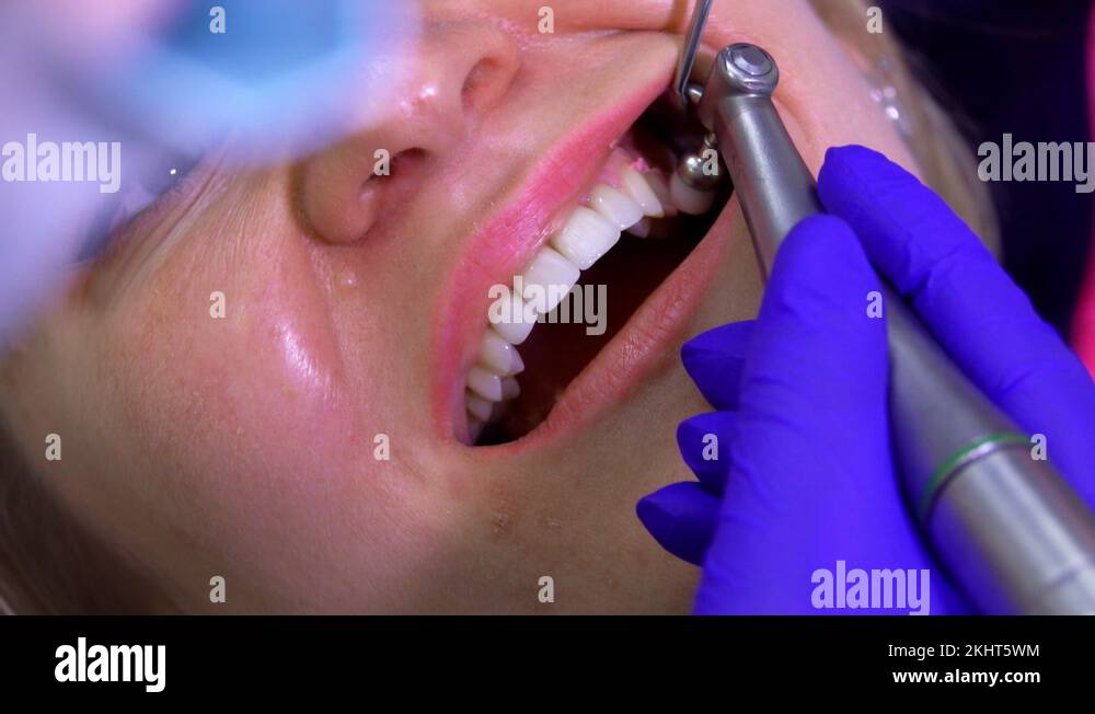 Patient mouth cleaning hospital Stock Videos & Footage - HD and 4K ...