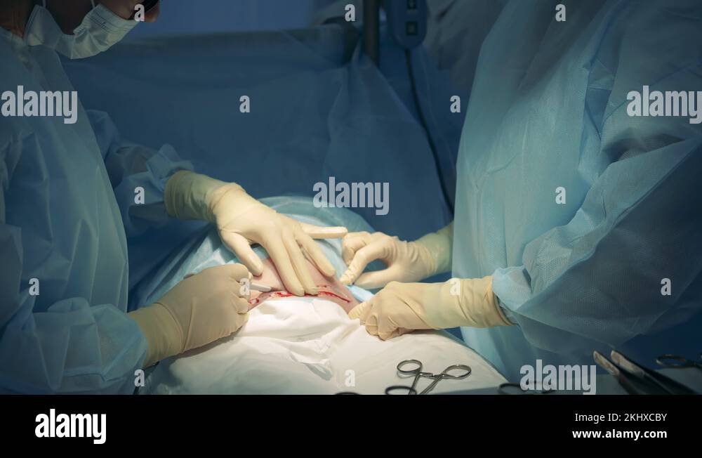 Stomach cutting Stock Videos & Footage - HD and 4K Video Clips - Alamy