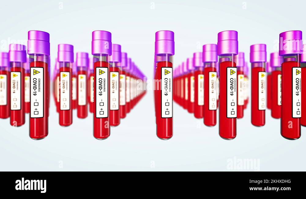 Blood test 4K COVID 19 Coronavirus outbreak animation .2019 ncov ...