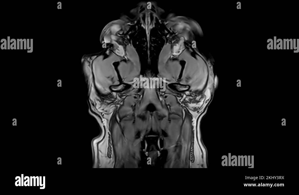 Dog skull anatomy Stock Videos & Footage - HD and 4K Video Clips - Alamy