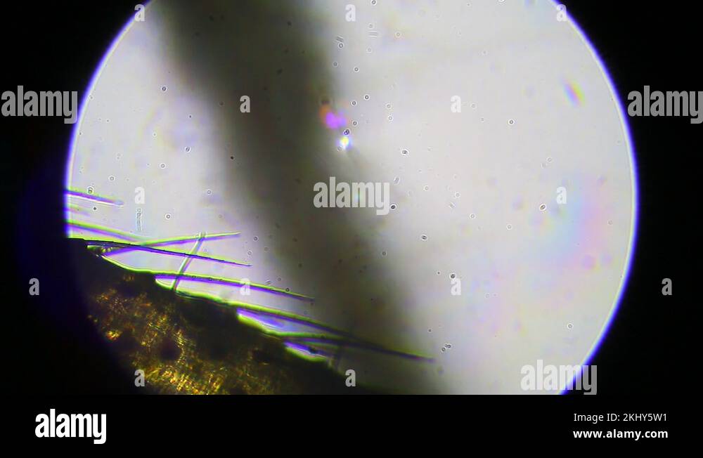 Spider legs under the microscope Stock Video Footage - Alamy