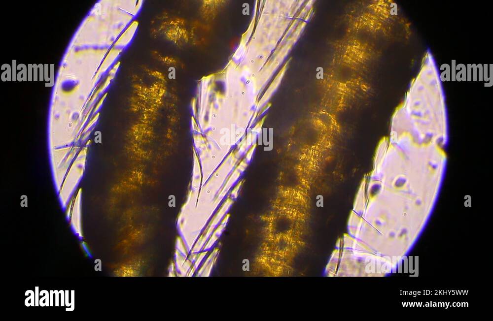 Spider legs under the microscope Stock Video Footage - Alamy