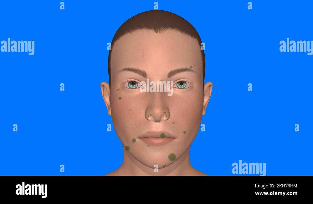 Fungal and viral diseases Stock Videos & Footage - HD and 4K Video ...