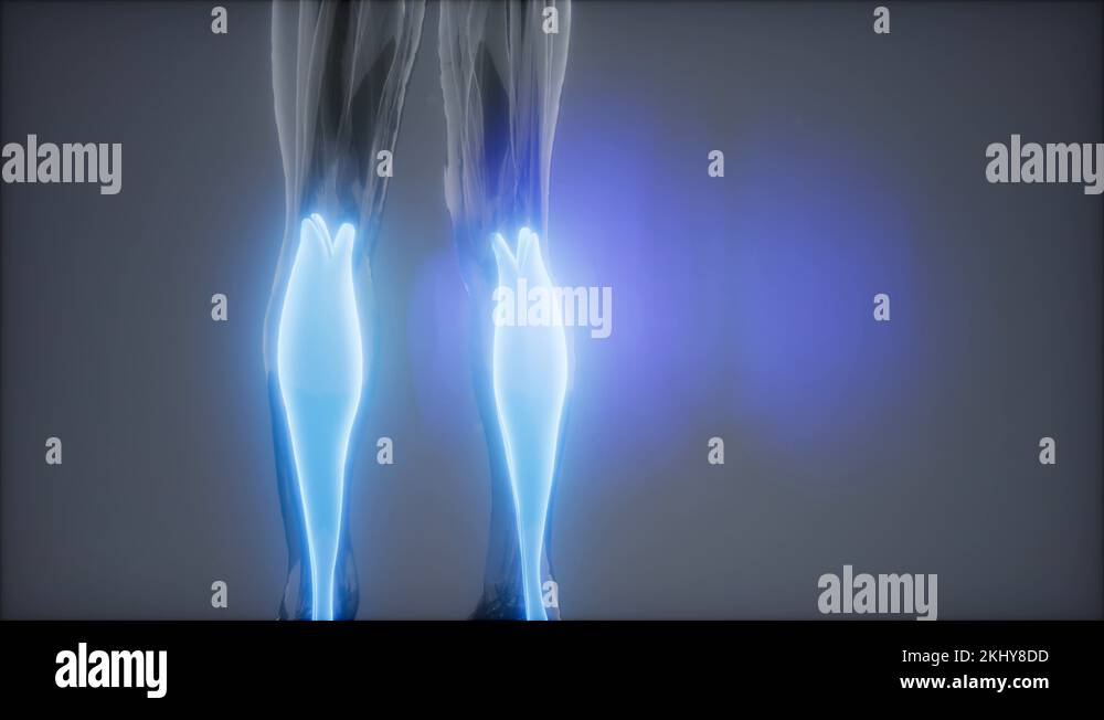 gastrocnemius- Visible muscle anatomy map Stock Video Footage - Alamy