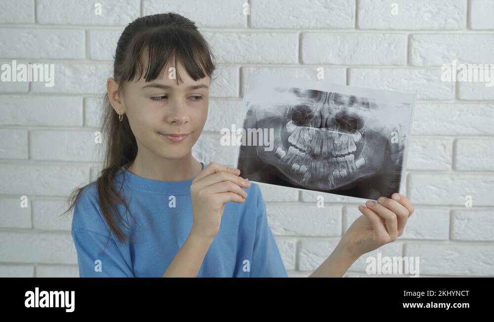 Picture of teeth Stock Videos & Footage - HD and 4K Video Clips - Alamy