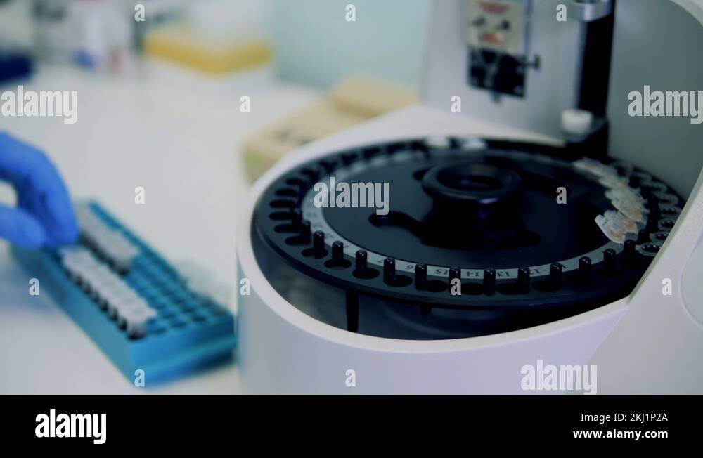 Coronavirus, covid-19 laboratory test. Small test tubes are being ...