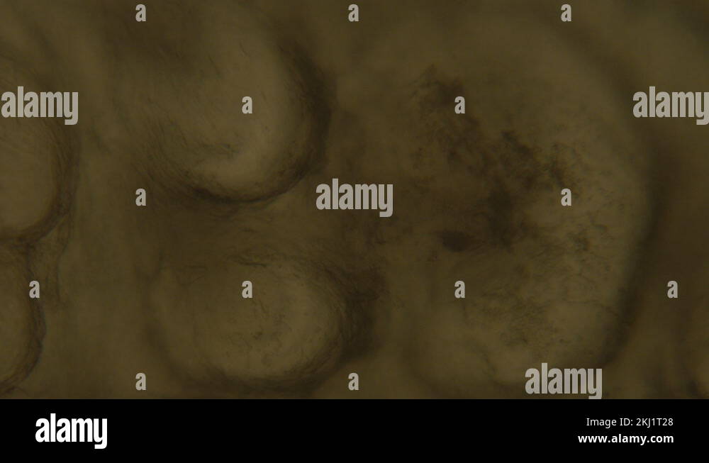 Epidermal cells with magnification Stock Videos & Footage - HD and 4K ...
