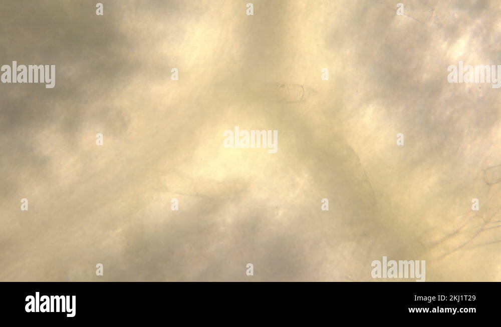 Microscopy of green plant (lettuce). Magnification 300x with visible ...