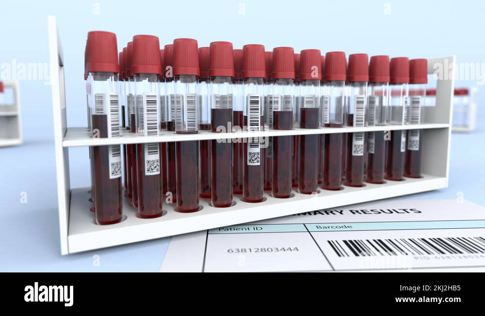 Blood sample test tubes Stock Videos & Footage - HD and 4K Video Clips ...