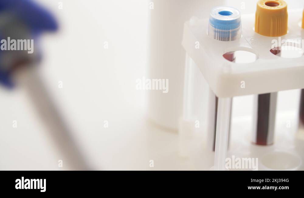 Beaker holder Stock Videos & Footage - HD and 4K Video Clips - Alamy