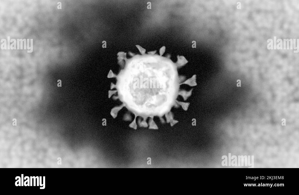 Electron microscope image of a virus Stock Videos & Footage - HD and 4K ...