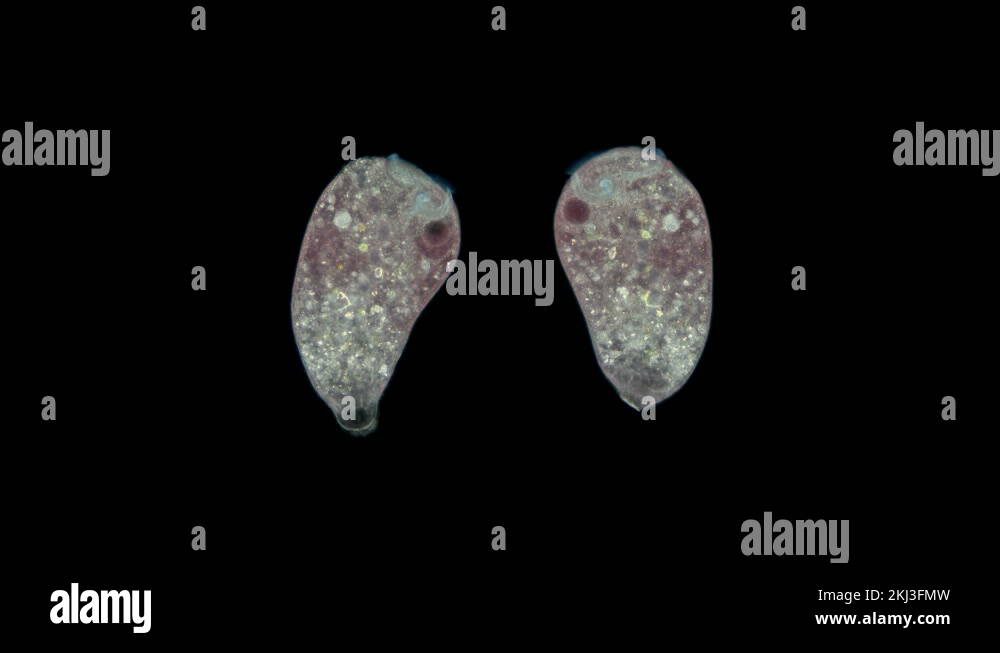 Infusoria Stentor under the microscope, the family Stentoridae, class ...