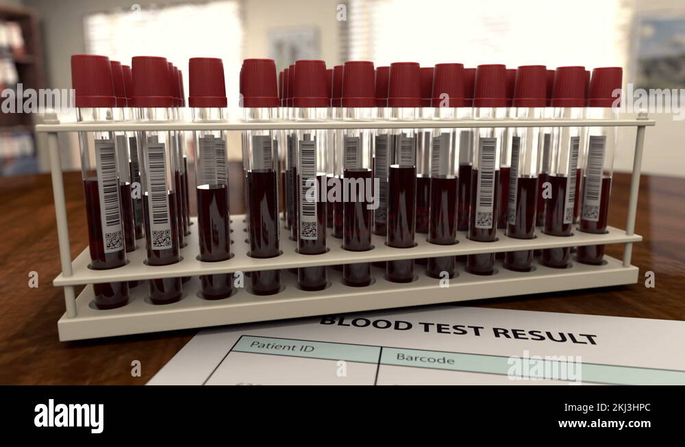 Hiv blood test form Stock Videos & Footage - HD and 4K Video Clips - Alamy
