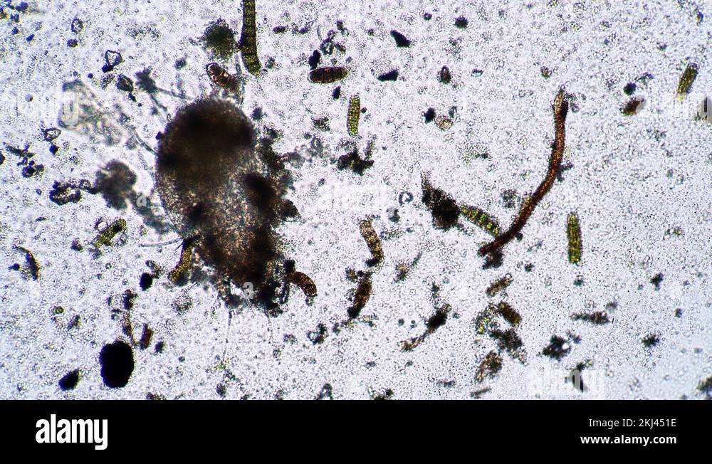 Die bacteria Stock Videos & Footage - HD and 4K Video Clips - Alamy