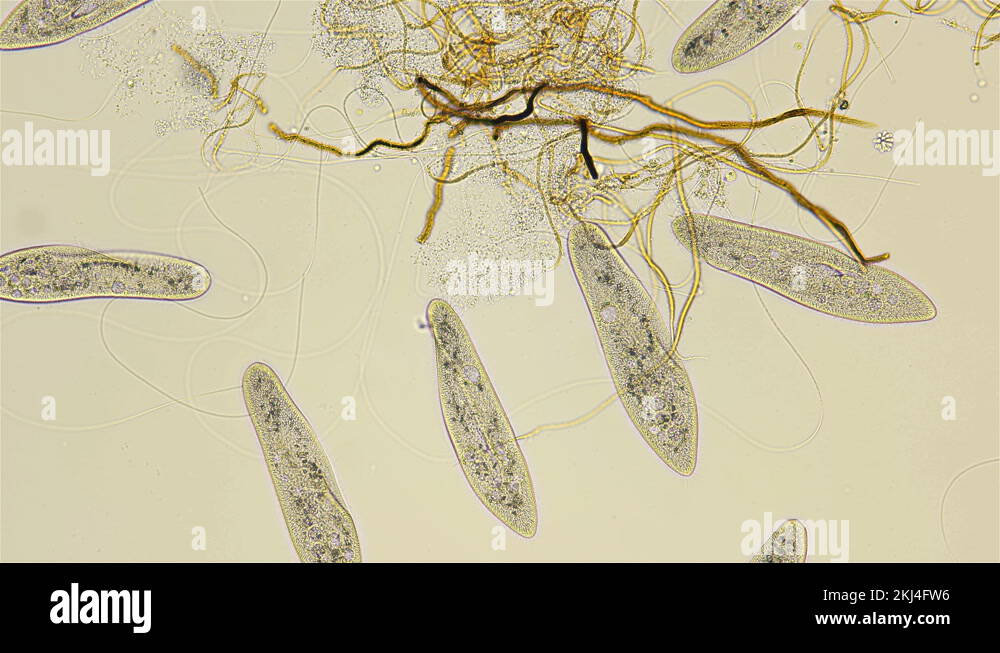 infusoria Paramécium caudátum under microscope, class Oligohymenophorea ...