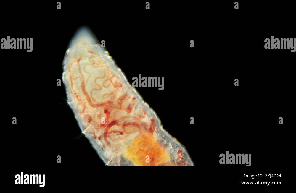 Tubifex worm under a microscope,Oligochaeta the Naididae family, type ...