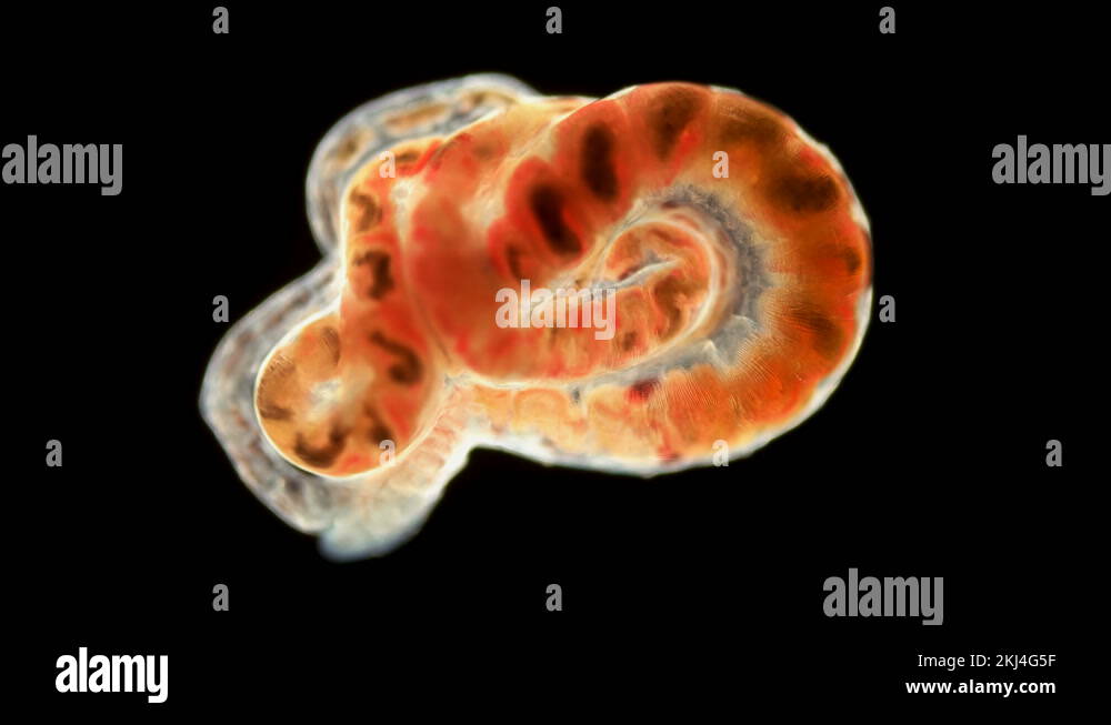 Tubifex worm under a microscope,Oligochaeta the Naididae family, type ...