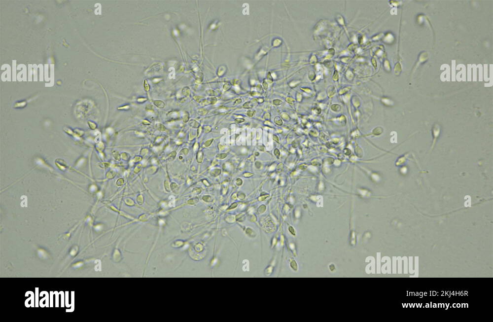 Human Sperm Under A Microscope Spermatozoa Consists Of Sperm And