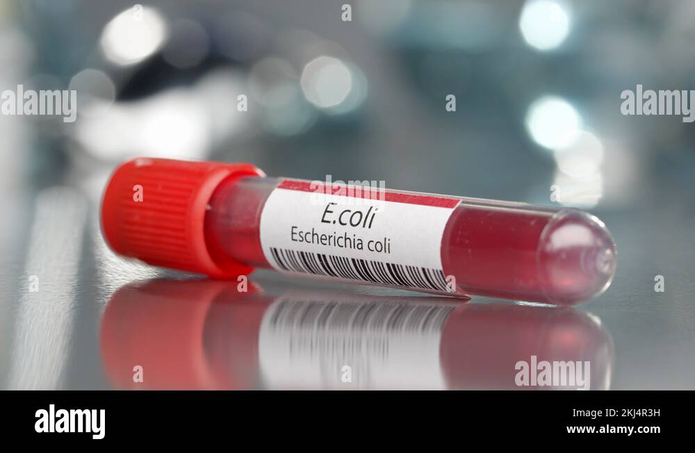 E coli escherichia coli Stock Videos & Footage - HD and 4K Video Clips ...