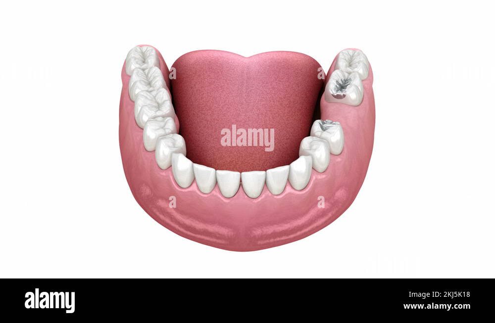 Bridge preparation Stock Videos & Footage - HD and 4K Video Clips - Alamy