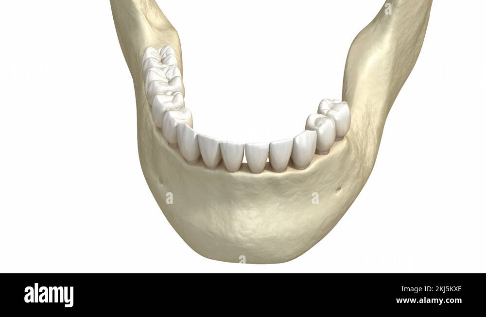 Alveolar bone Stock Videos & Footage - HD and 4K Video Clips - Alamy