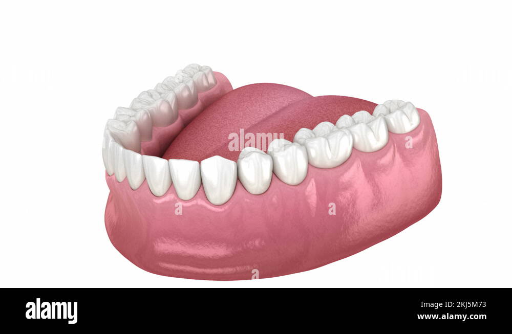 Lingual golden braces system. 3D animation concept of golden braces ...