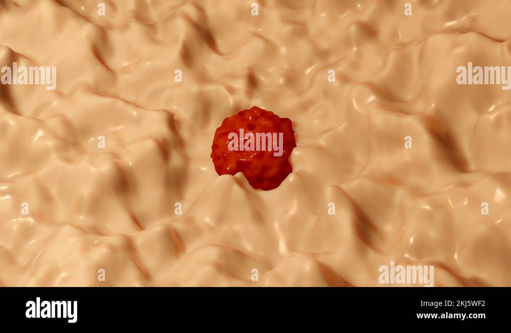 3D rendered animation, visualisation of a growing polyp Stock Video ...