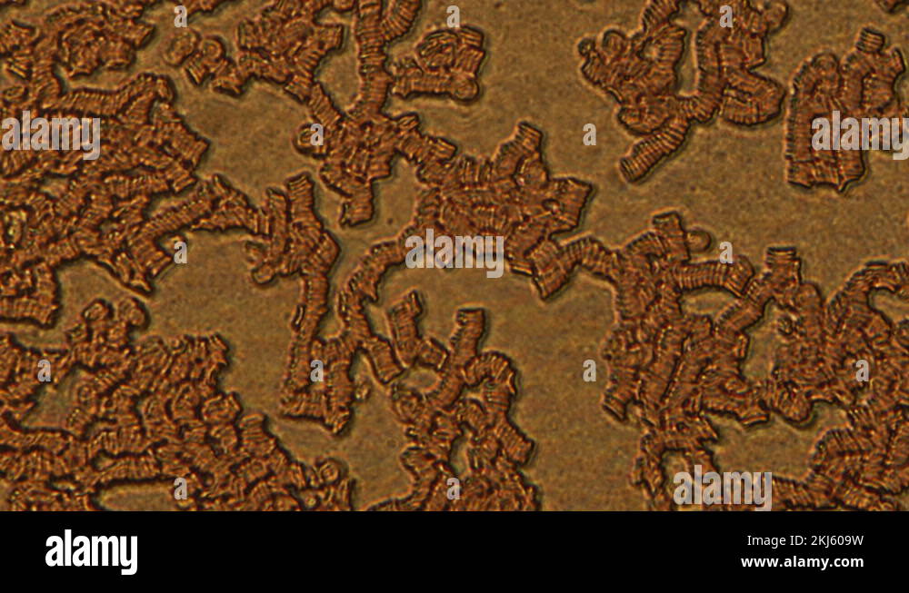 Microscopy of human blood cell test. Magnification 300x moving of red ...