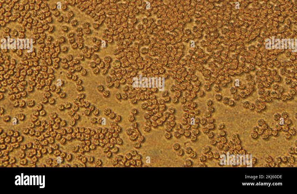 Microscopy of human blood cell test. Magnification 300x moving of red ...