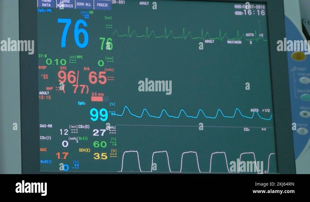 Monitoring screen Stock Videos & Footage - HD and 4K Video Clips - Alamy