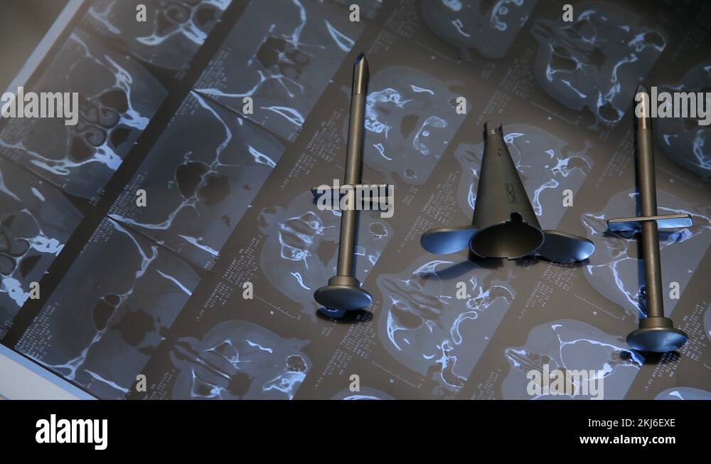 Ent Stock Videos & Footage - HD and 4K Video Clips - Alamy