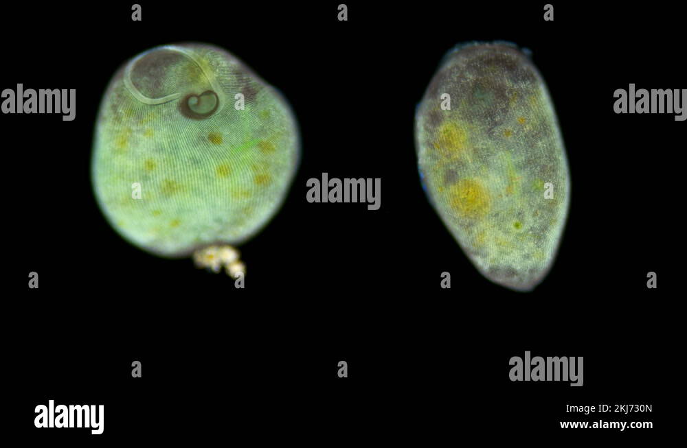 Infusoria Stentor under the microscope, the family Stentoridae, class ...